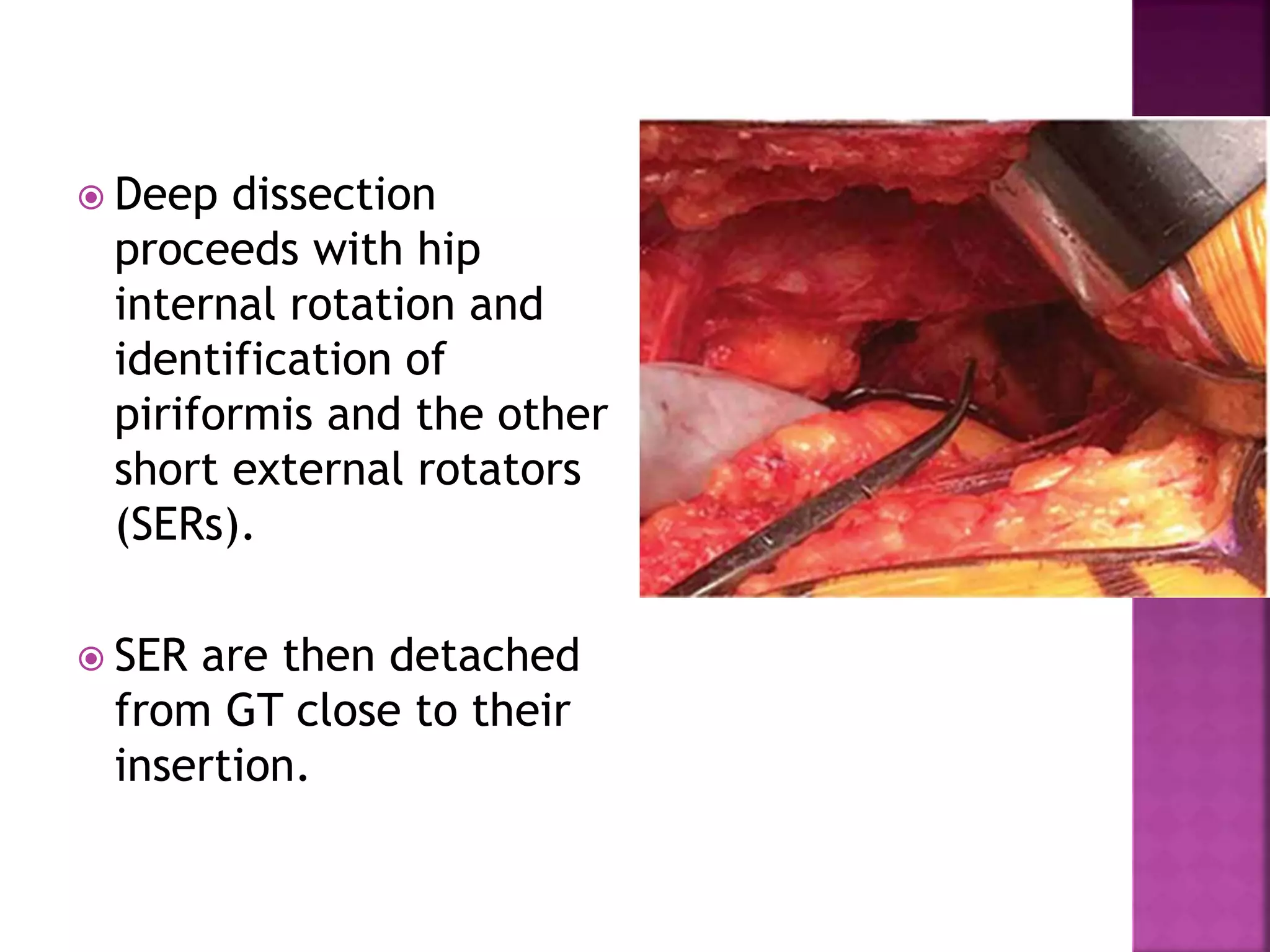 Thr approaches journal | PPTX