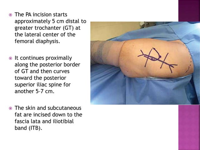 Thr approaches journal | PPTX