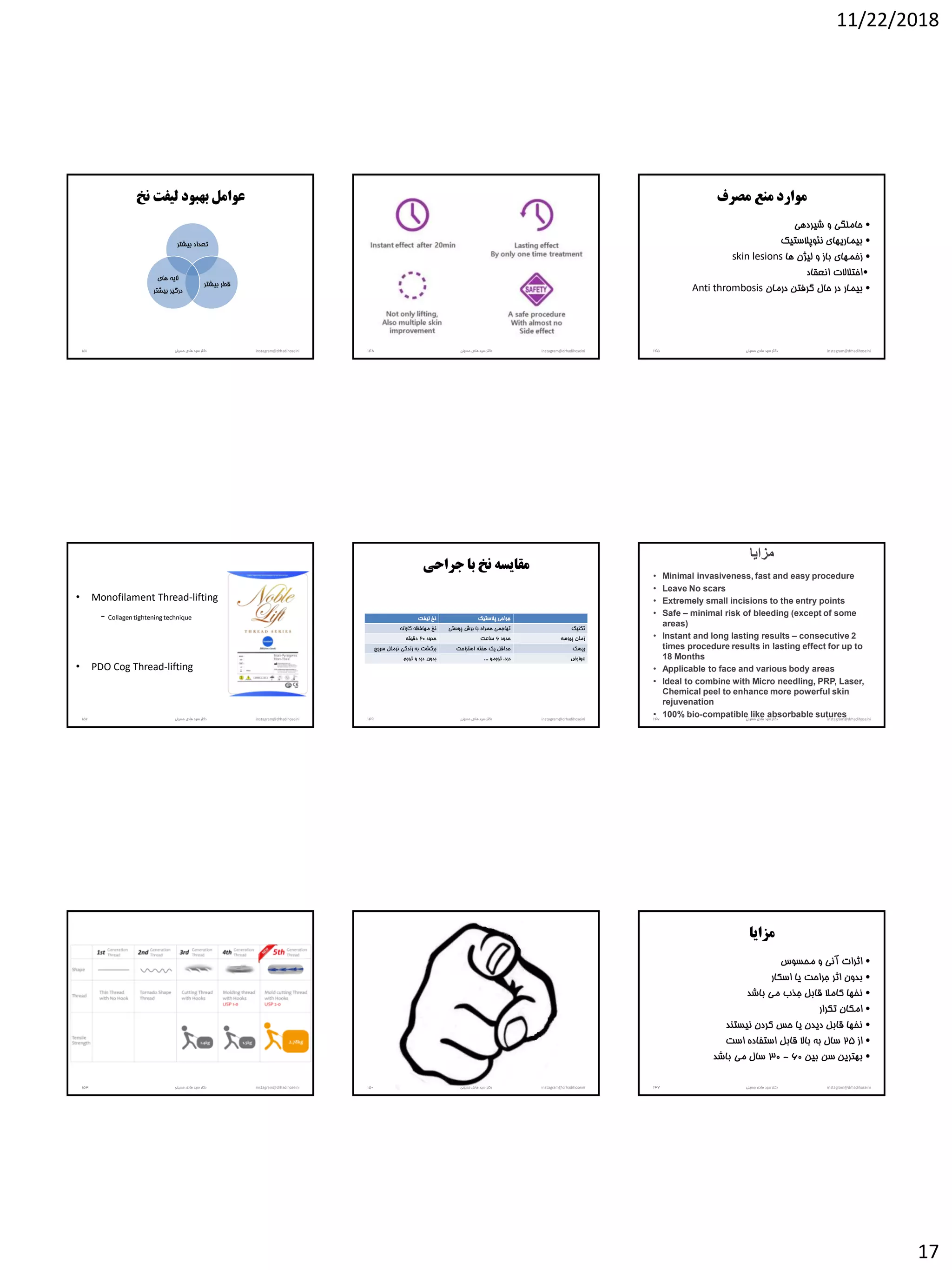 Thread lifting principles | PDF