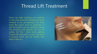 Thread lift treatment | PPTX