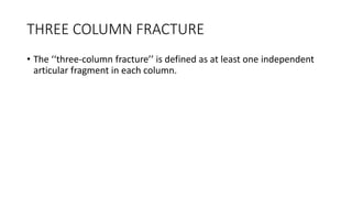 Three column fixation for complex PROXIMAL TIBIA FRACTURES | PPTX