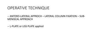 Three column fixation for complex PROXIMAL TIBIA FRACTURES | PPTX