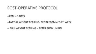 Three column fixation for complex PROXIMAL TIBIA FRACTURES | PPTX