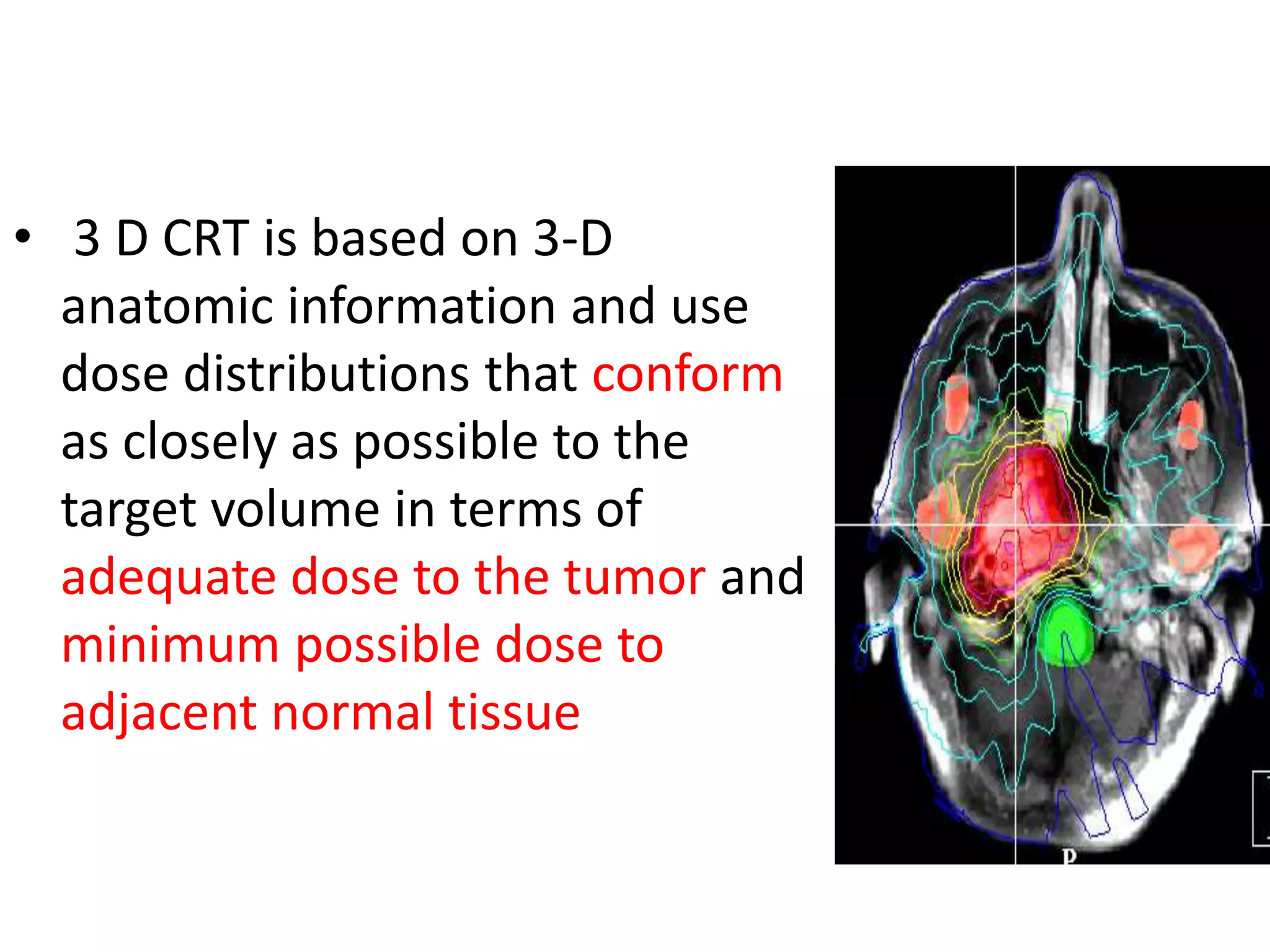Three dimensional conformal radiation therapy | PPTX