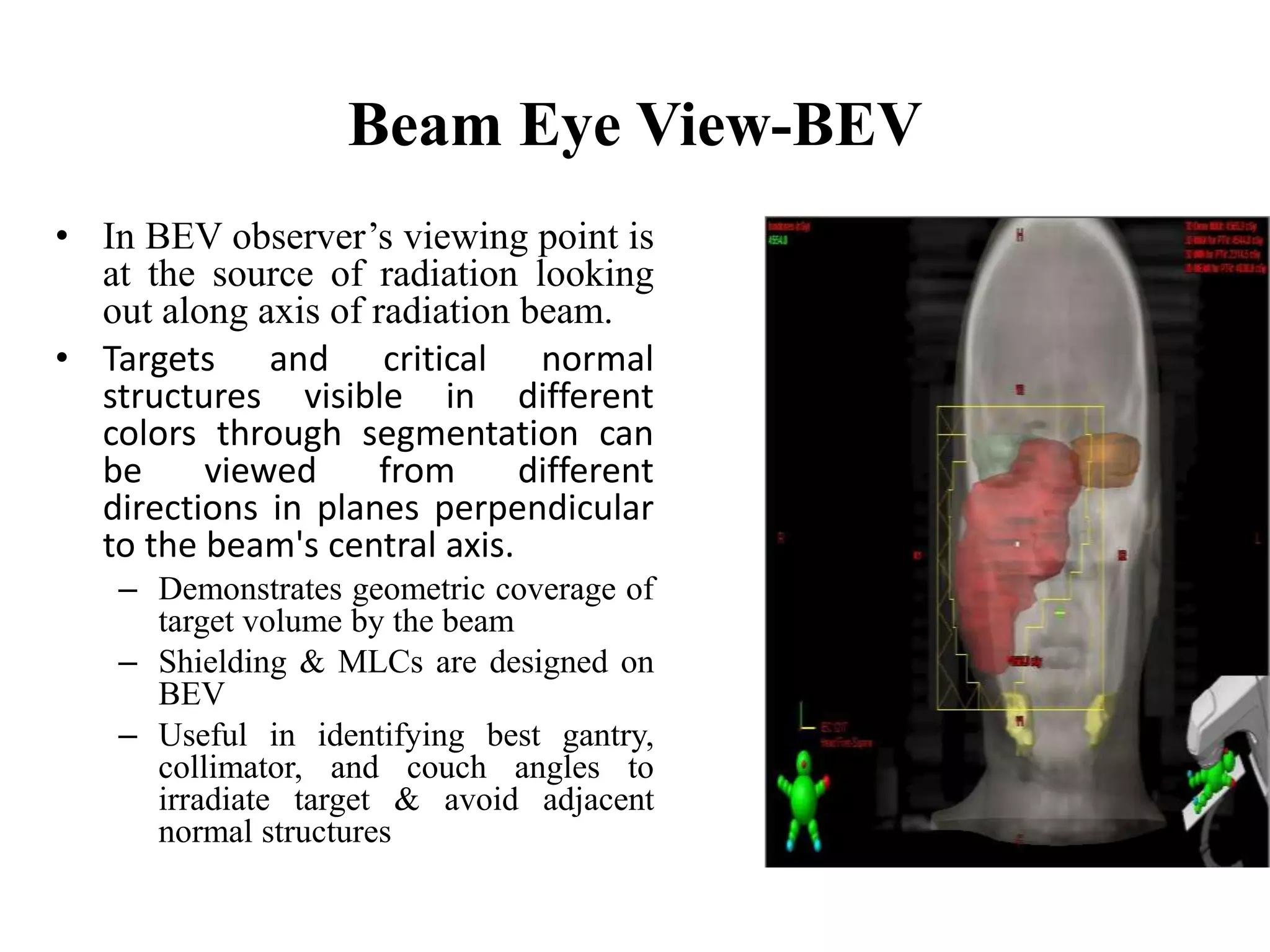 Three dimensional conformal radiation therapy | PPTX
