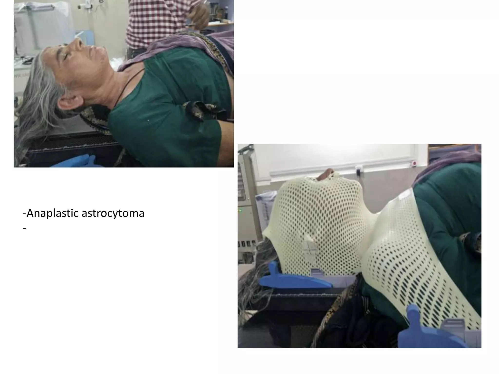 Three dimensional conformal radiation therapy | PPTX