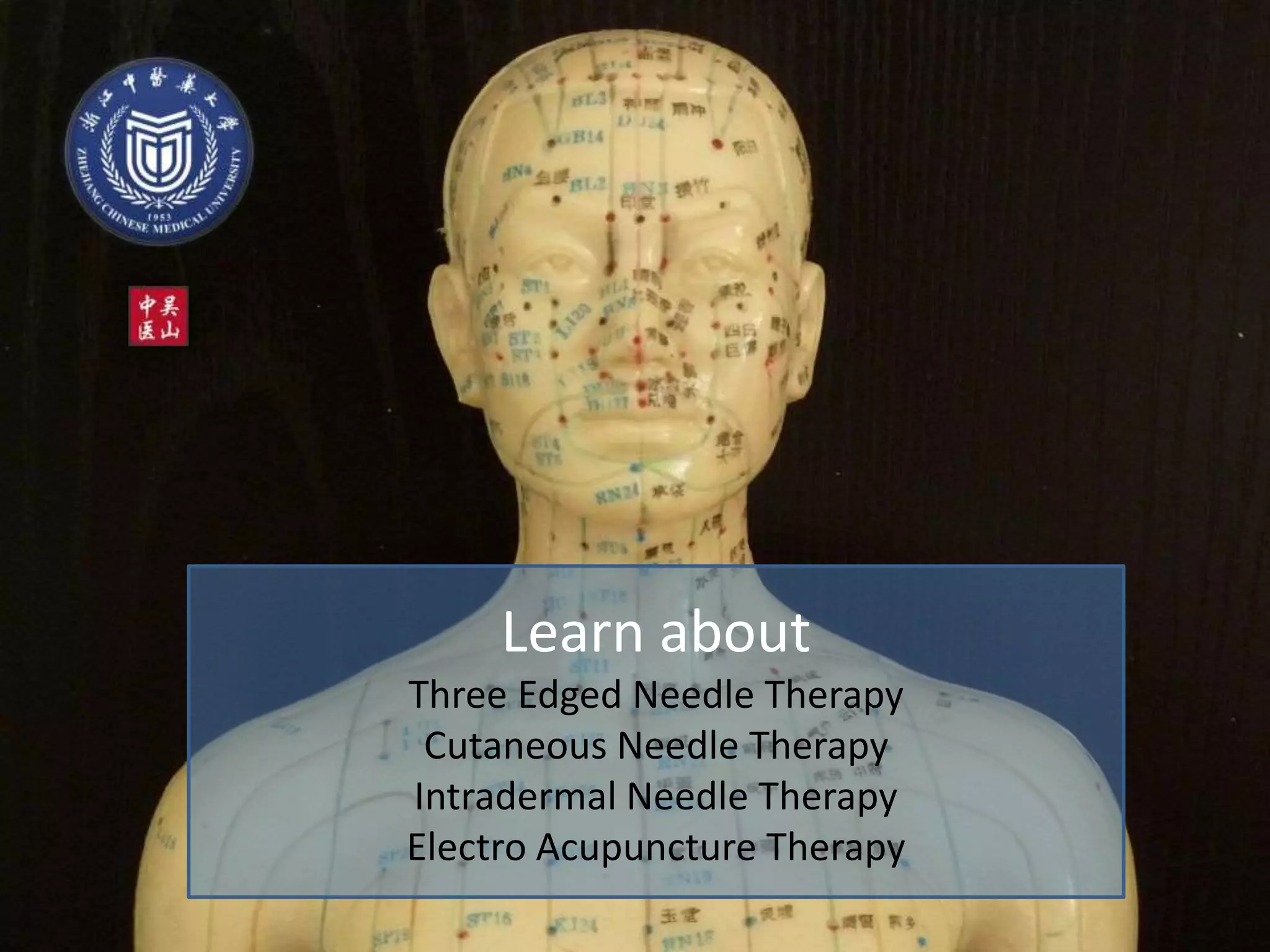 Three edged cutaneous - intradermal needle therapy | PPT