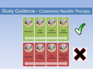 Three edged cutaneous - intradermal needle therapy | PPT