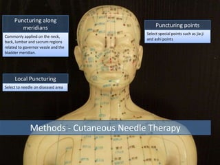 Three edged cutaneous - intradermal needle therapy | PPT