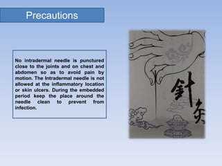 Three edged cutaneous - intradermal needle therapy | PPT