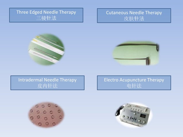 Three edged cutaneous - intradermal needle therapy | PPT