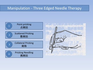 Three edged cutaneous - intradermal needle therapy | PPT