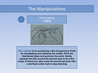 Three edged cutaneous - intradermal needle therapy | PPT