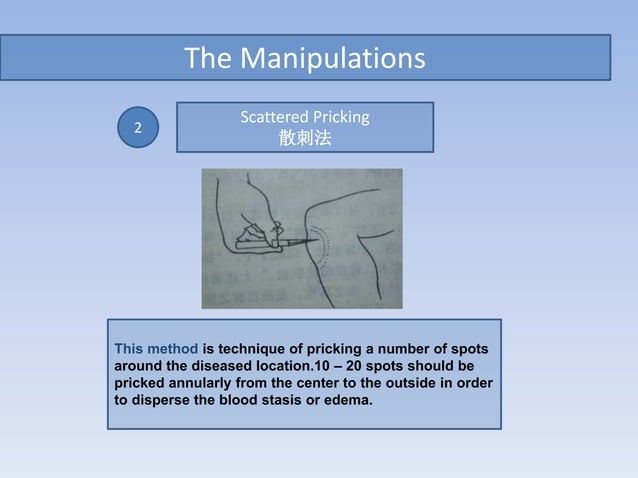 Three edged cutaneous - intradermal needle therapy | PPT
