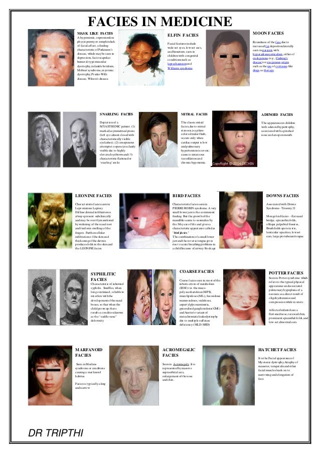 Faces in medicine