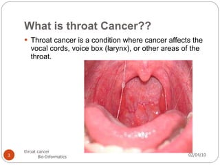 Throat Cancer | PPT