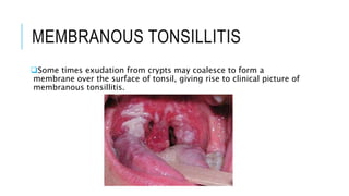 Throat, Anatomy and clinical diseases | PPTX