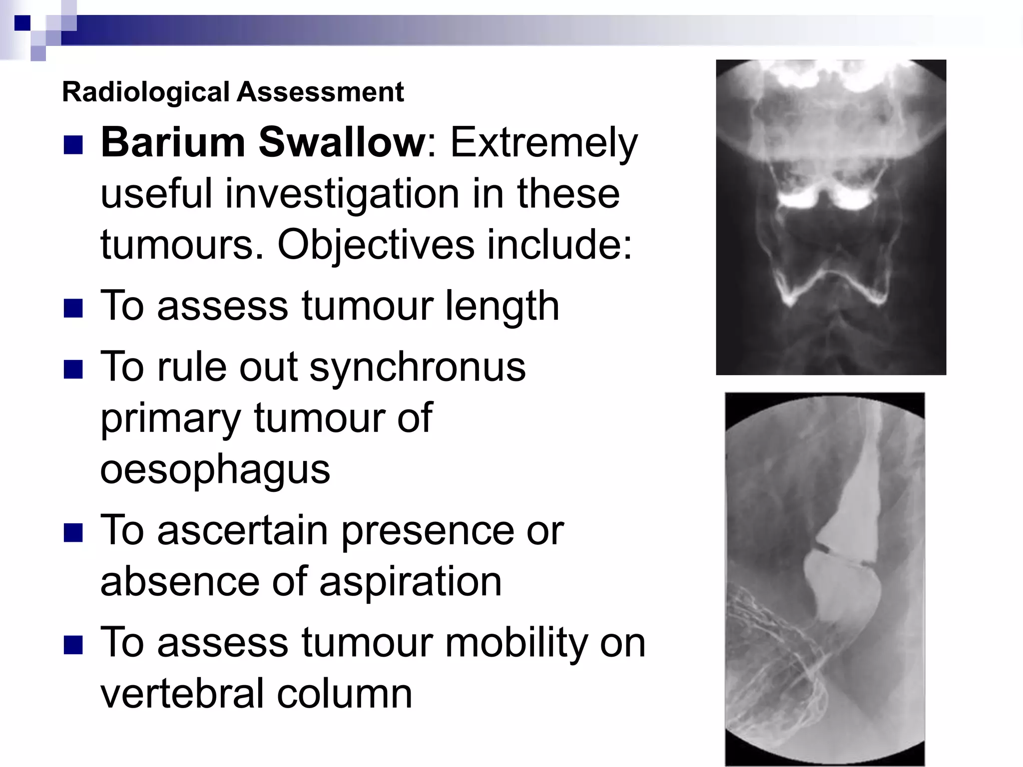 Throat_Pharynx_Carcinoma Hypopharynx_ENT_lectures-2.pptx