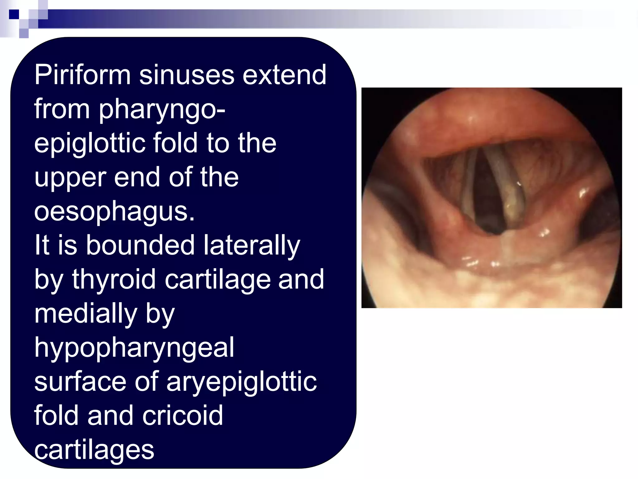 Throat_Pharynx_Carcinoma Hypopharynx_ENT_lectures-2.pptx