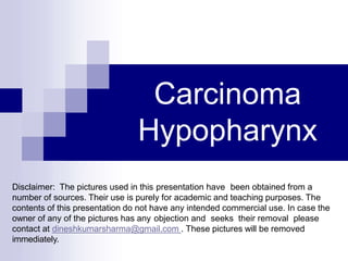 Throat_Pharynx_Carcinoma Hypopharynx_ENT_lectures-2.pptx
