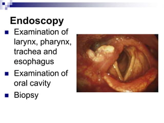 Throat_Pharynx_Carcinoma Hypopharynx_ENT_lectures-2.pptx