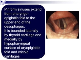 Throat_Pharynx_Carcinoma Hypopharynx_ENT_lectures-2.pptx