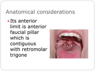 Throat_Pharynx_Carcinoma_Oropharynx_ENT_Lectures.ppt