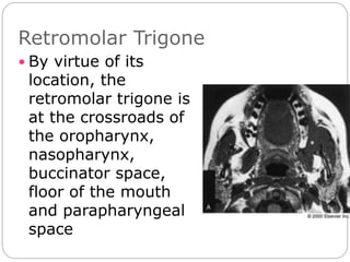 Throat_Pharynx_Carcinoma_Oropharynx_ENT_Lectures.ppt