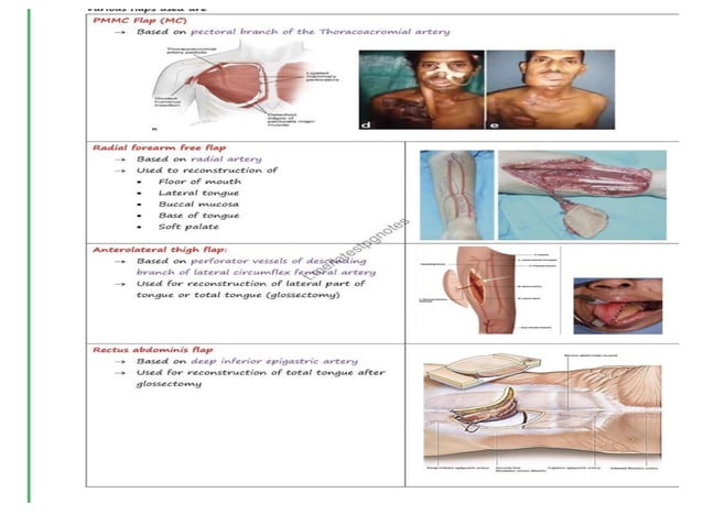 Throat_Pharynx_Carcinoma_Oropharynx_ENT_Lectures.pptx