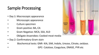 Throat Swab, Sputum and Pus.pptx