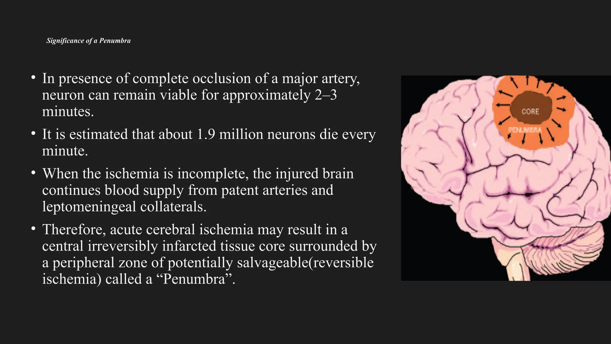 Intravenous acute ischemic stroke including thrombectomy | PPTX