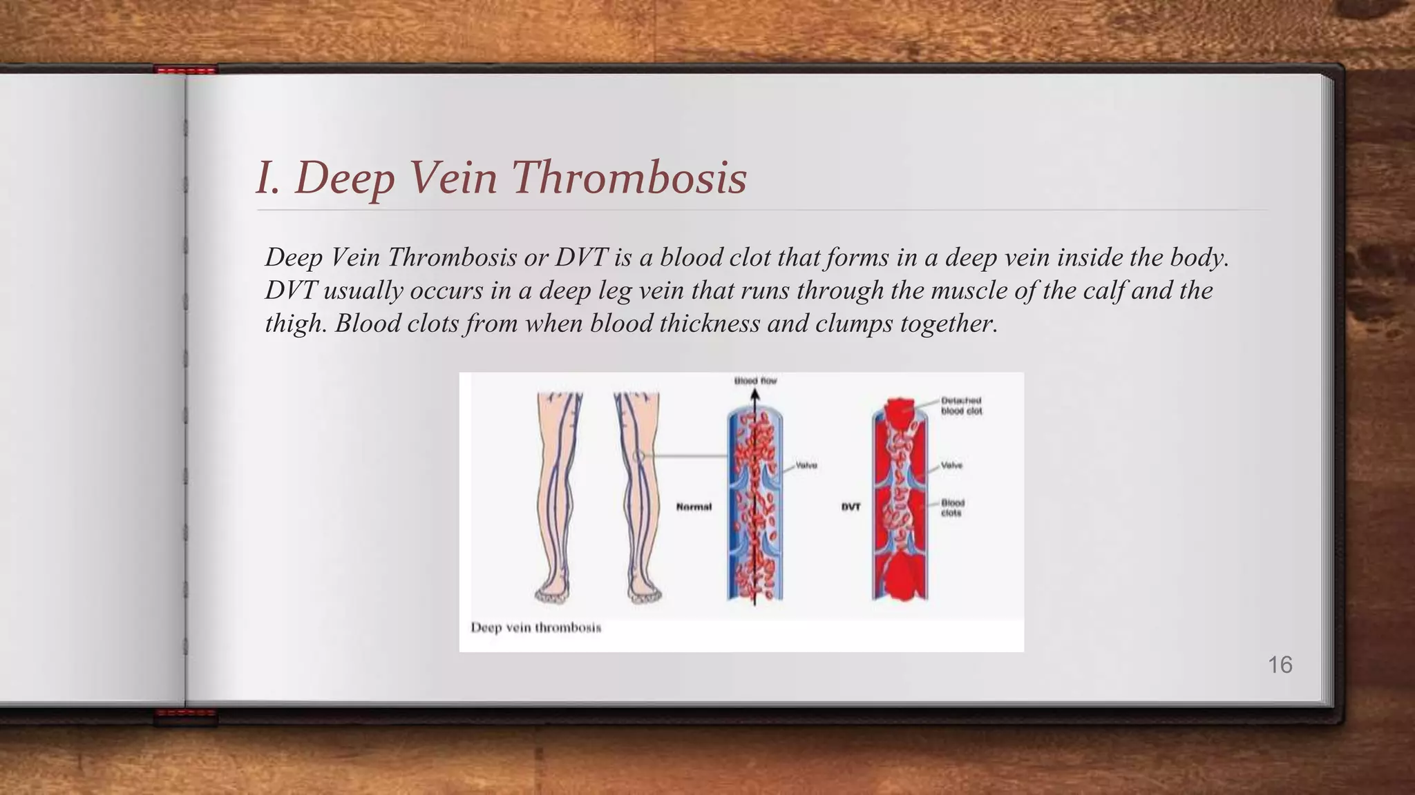 Thrombo embolic disorders in postnatal period | PPTX