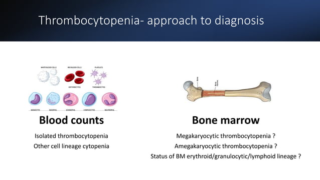 Approach to thrombocytopenia.pptx | Blood Disorders | Diseases and ...