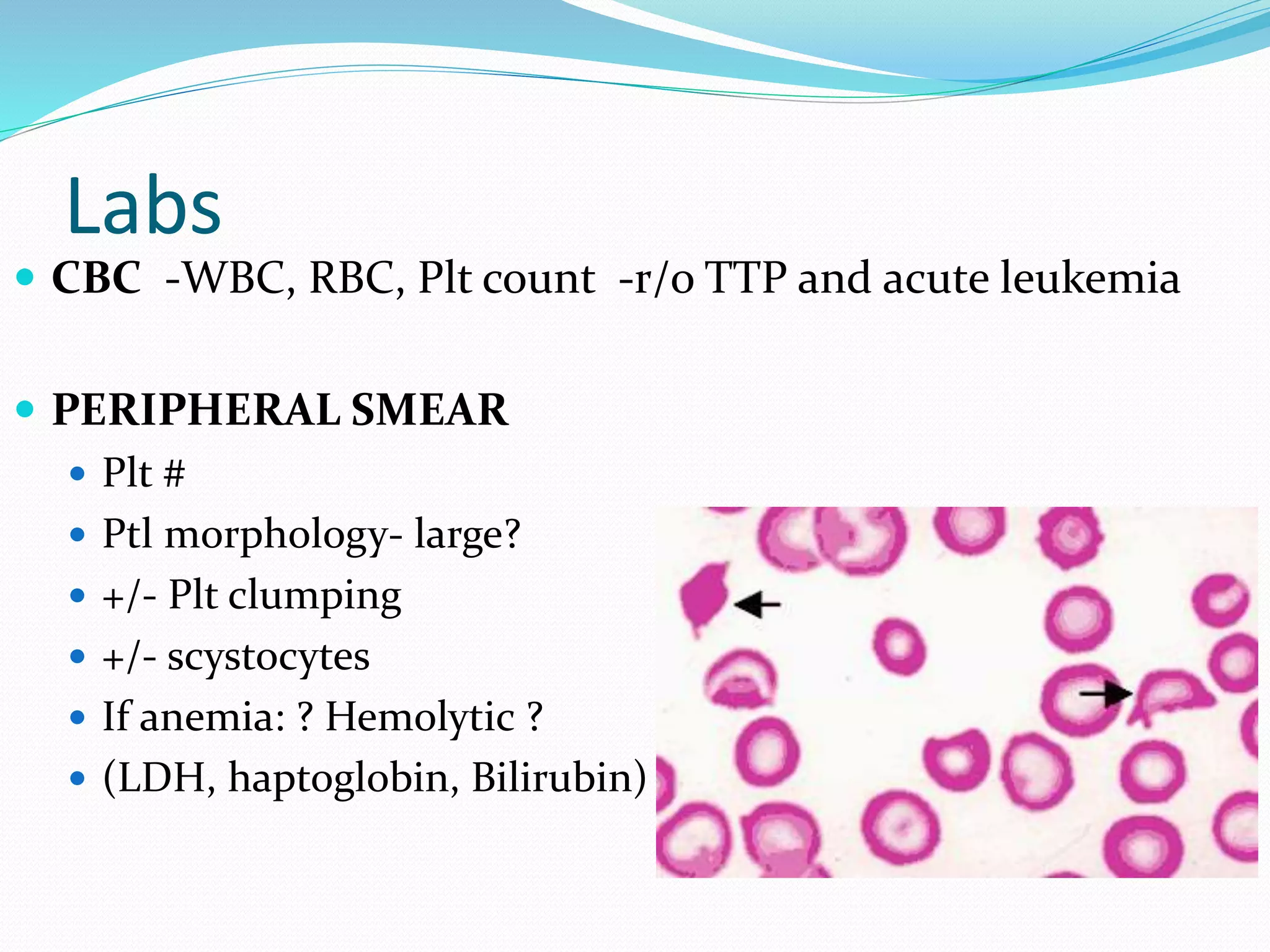 Thrombocytopenia | PPSX