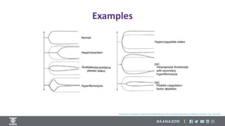 Thromboelastography-Final-Presentation.pptx
