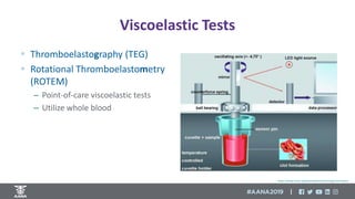 Thromboelastography-Final-Presentation.pptx