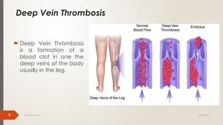 Thromboembolic Disorders (Deep Vein Thrombosis).pptx