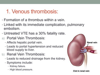 Thromboembolism and Elderly | PPTX
