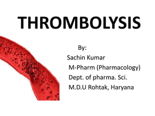 Thrombolysis | PPTX