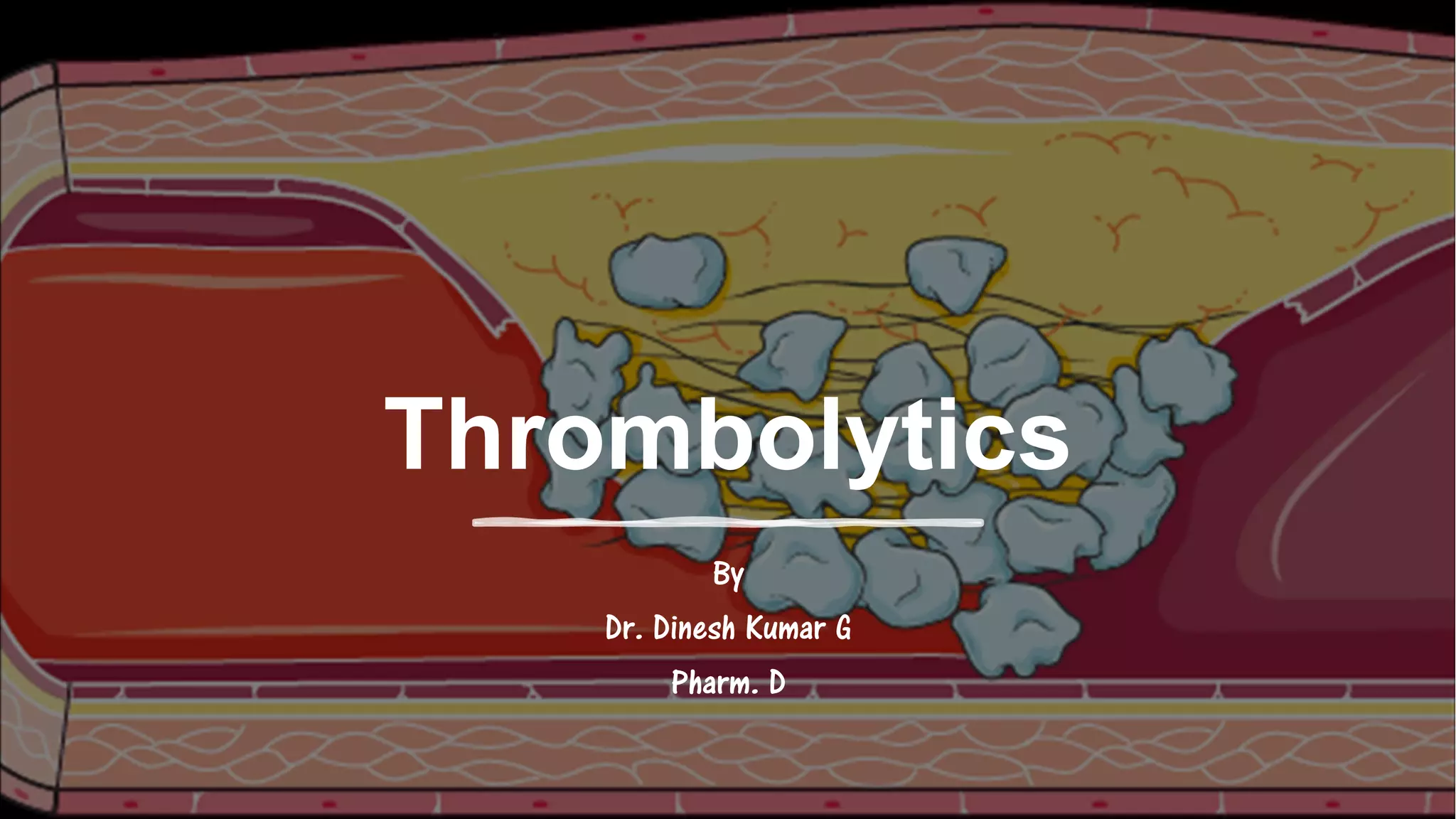 Thrombolytics | PPT