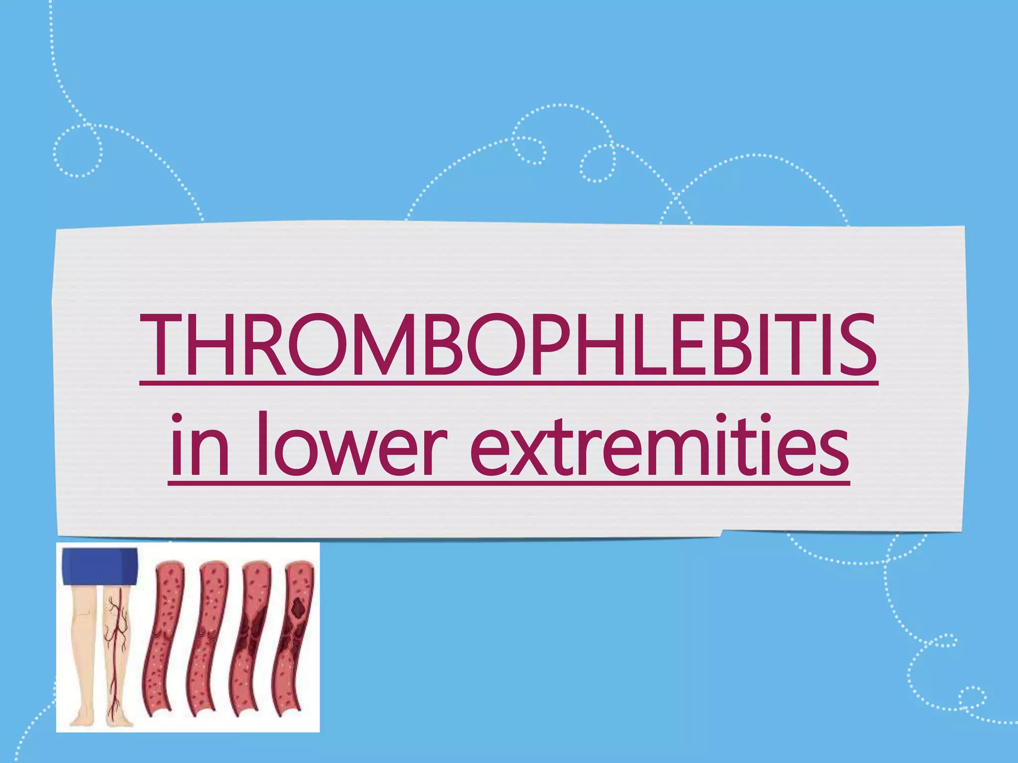 Thrombophlebitis and DVT ppt | PPTX
