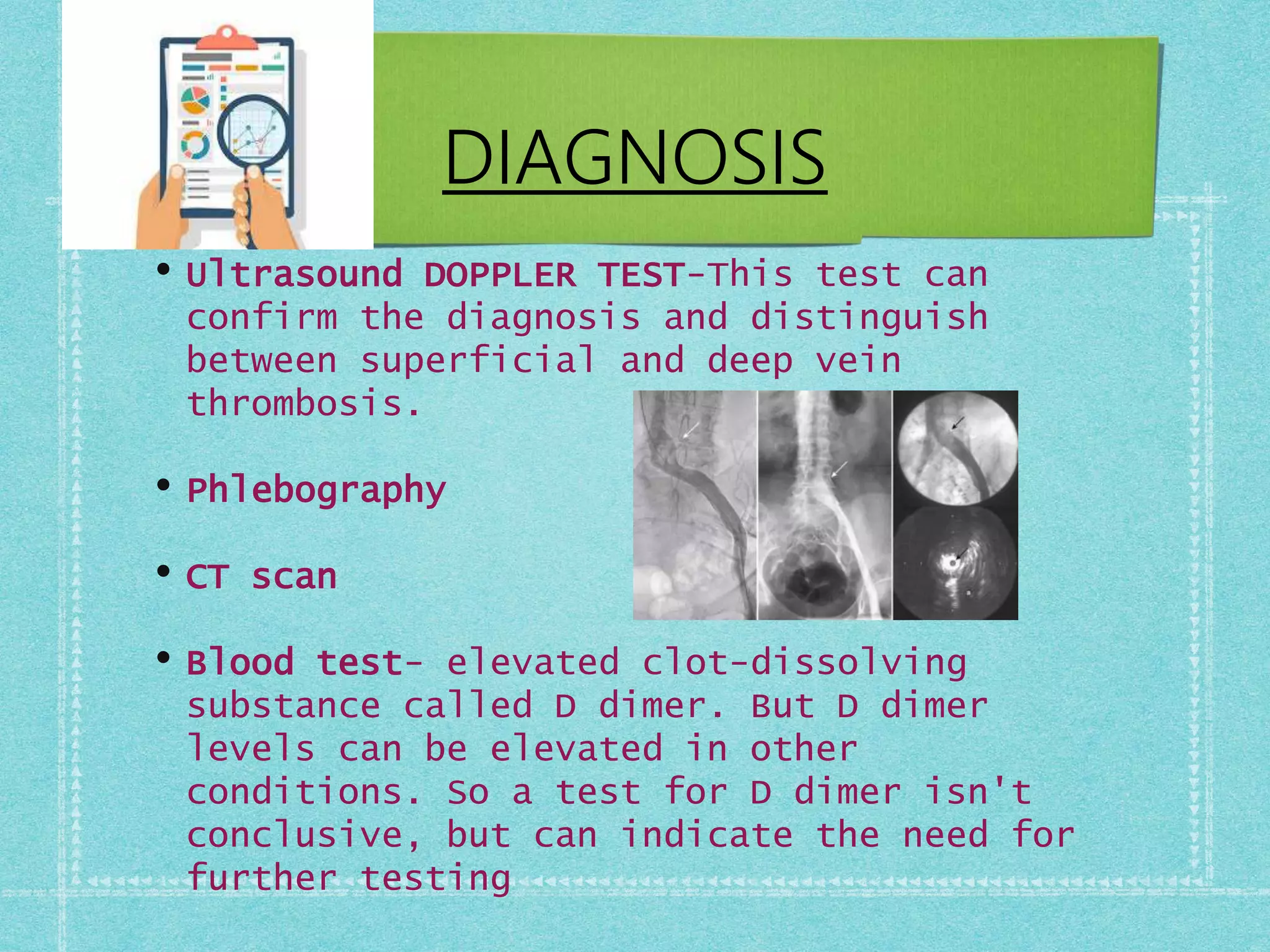Thrombophlebitis and DVT ppt | PPTX