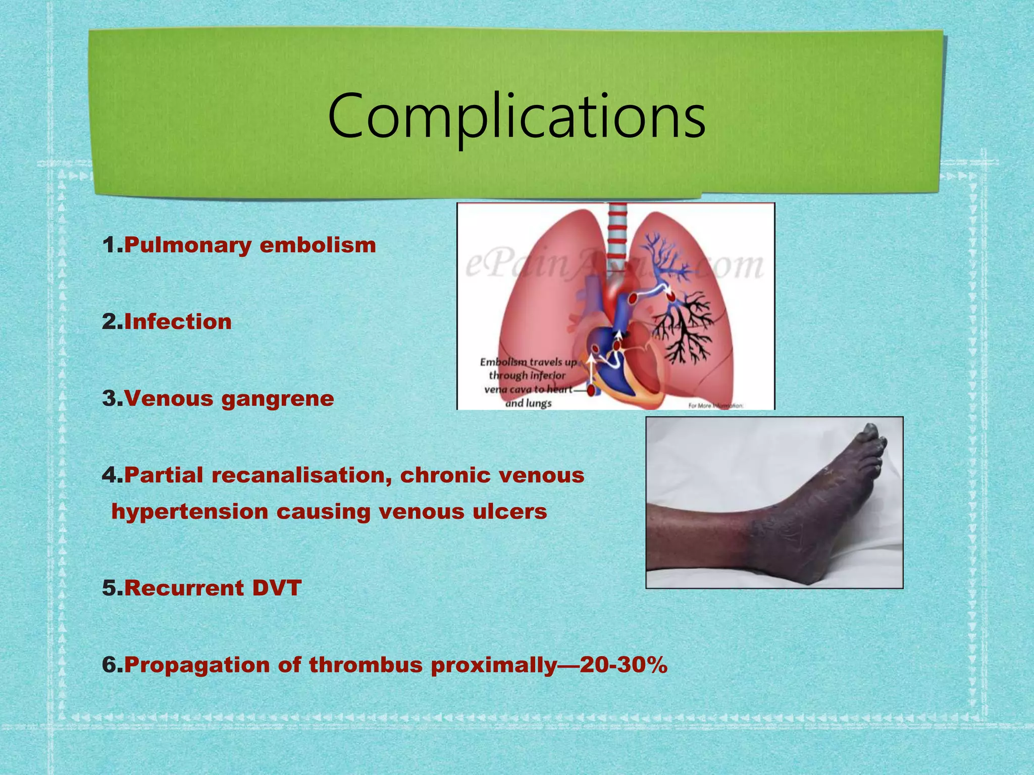 Thrombophlebitis and DVT ppt | PPTX