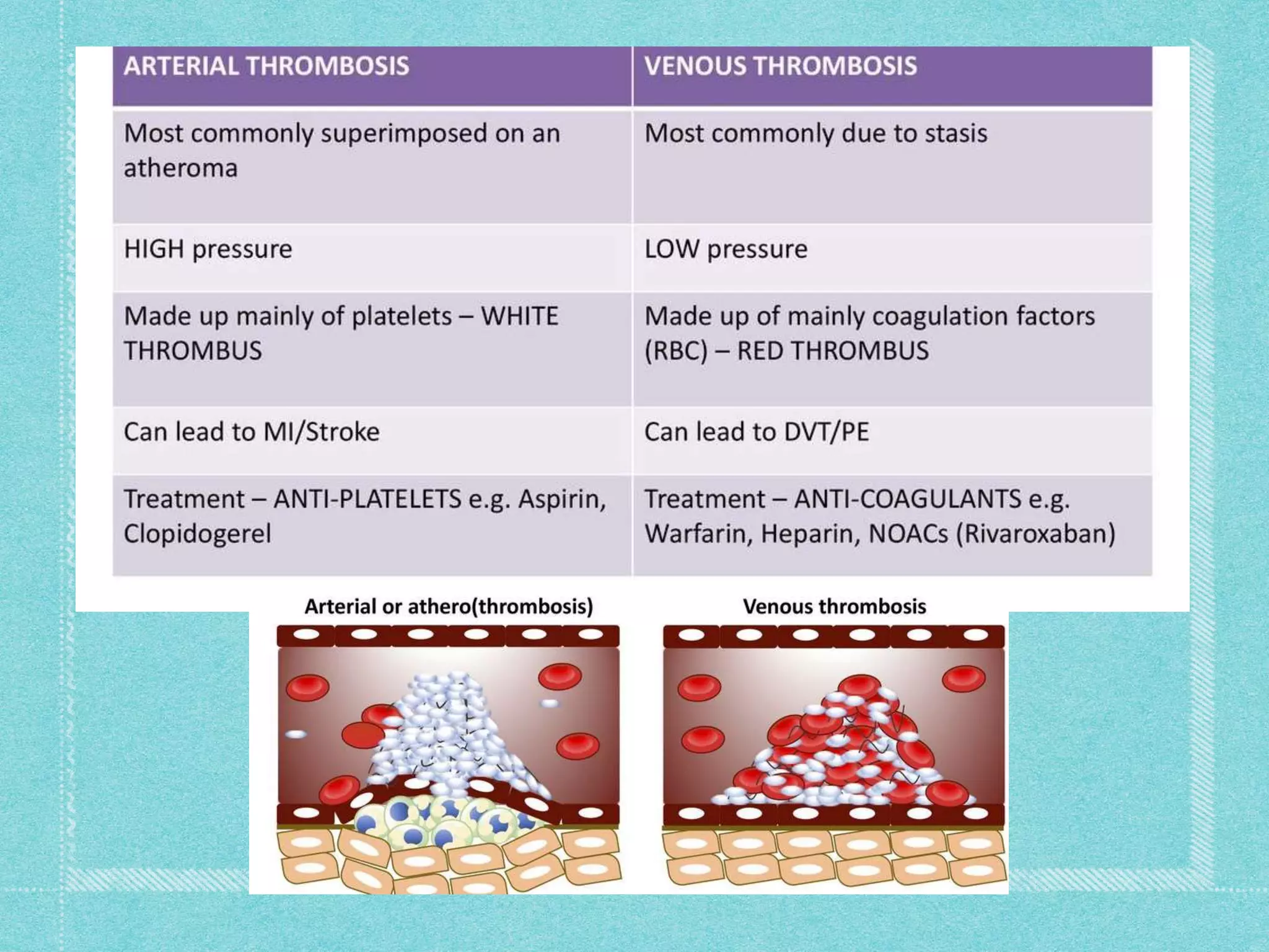 Thrombophlebitis and DVT ppt | PPTX