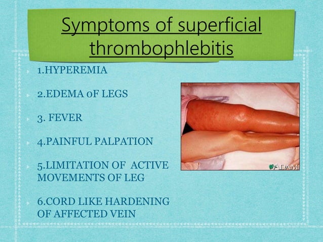 Thrombophlebitis and DVT ppt | PPTX