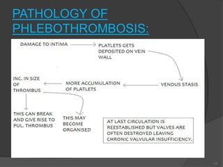 thrombophlebitis and phlebothrombosis.pptx