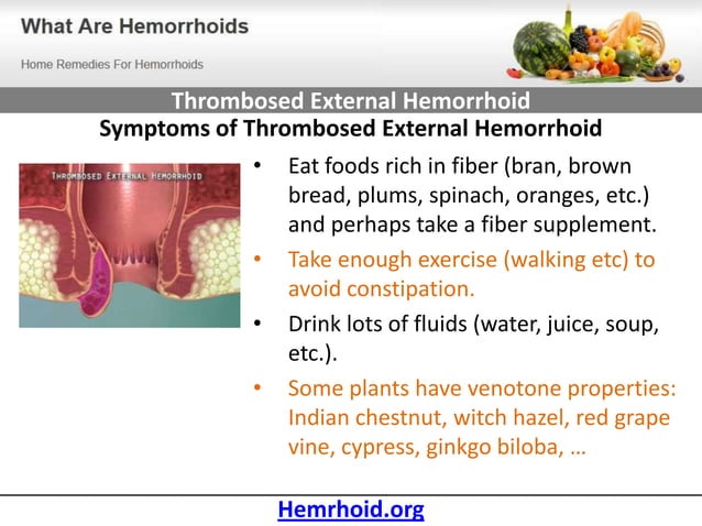 Thrombosed External Hemorrhoid | PPTX | Digestive Disorders | Diseases and Conditions