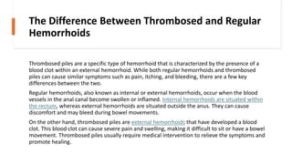 Thrombosed Piles - Symptoms and Treatment Options.pdf