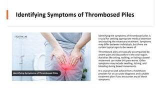 Thrombosed Piles - Symptoms and Treatment Options.pdf