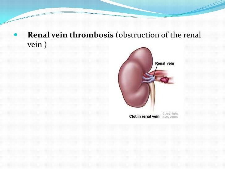 Thrombosis